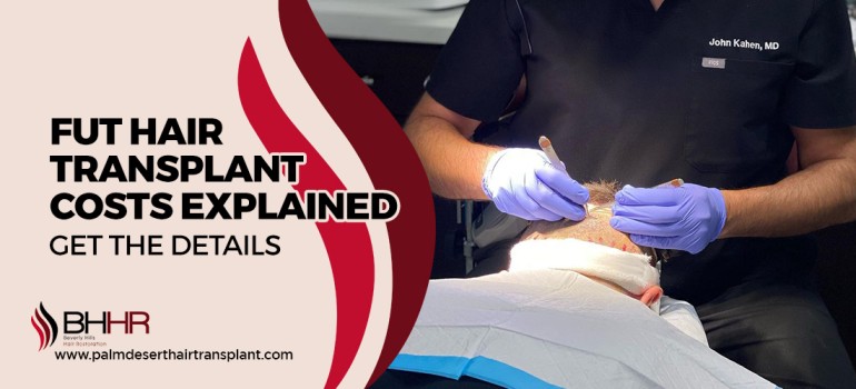 FUT hair transplant cost | Beverly Hills Hair Restoration